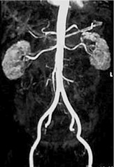 Angioresonancia – CDyTE